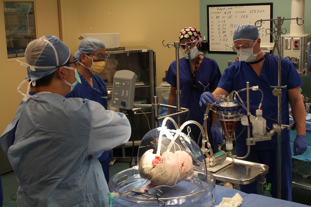 A beam of light that could be a game changer for transplant – UHN ...