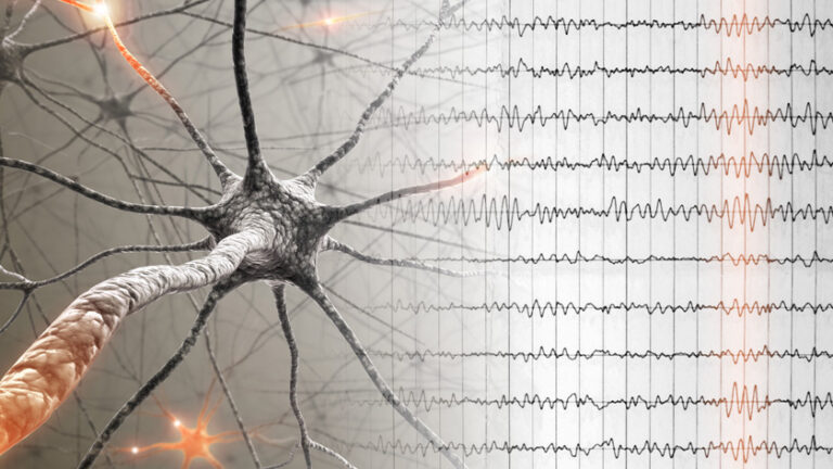 Decoding Neural Signs Uhn Foundation