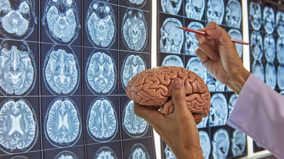 Imagining a more equitable future for acquired brain injury care – UHN ...